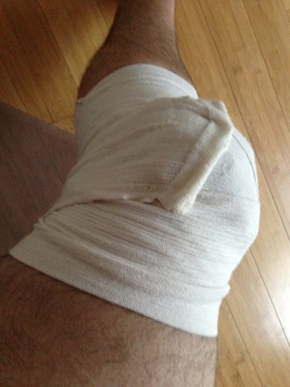 The Half Blind Woodworker: Odd woodworking related injuries